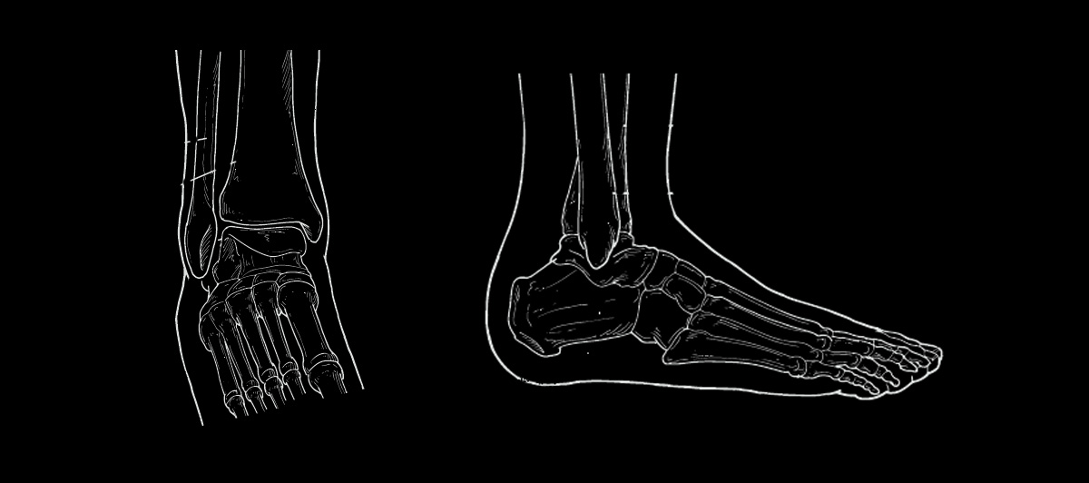 ANKLE FRACTURES | Tucson Foot & Ankle Institute